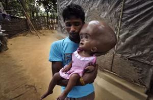 Baby Roona's Death: How Did Baby Roona Die?