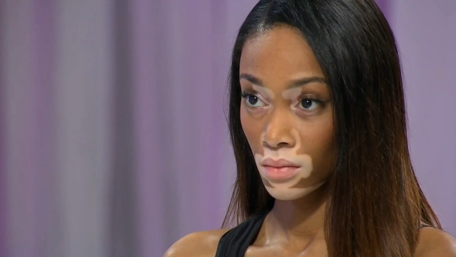 Winnie Harlow Now: Where is ANTM Season 21's Model Now? Update