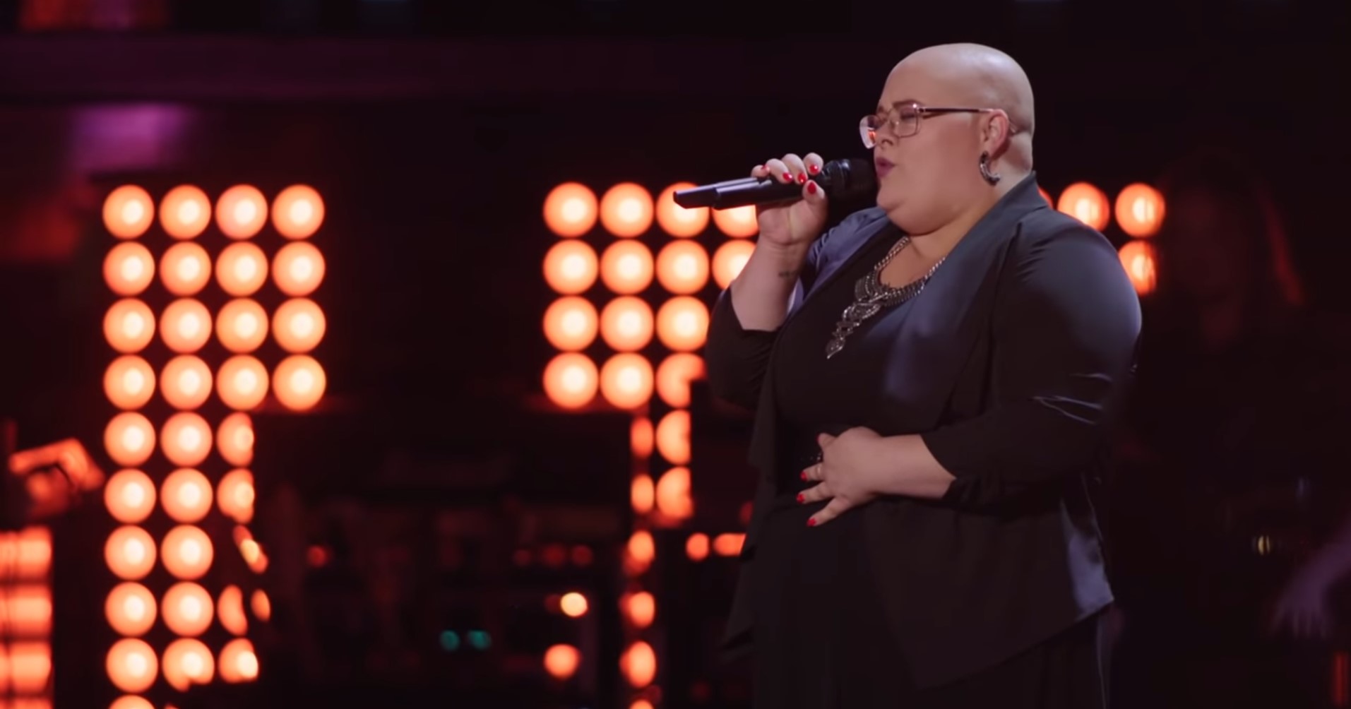 Why is The Voice's Holly Forbes Bald? Does She Have Cancer?