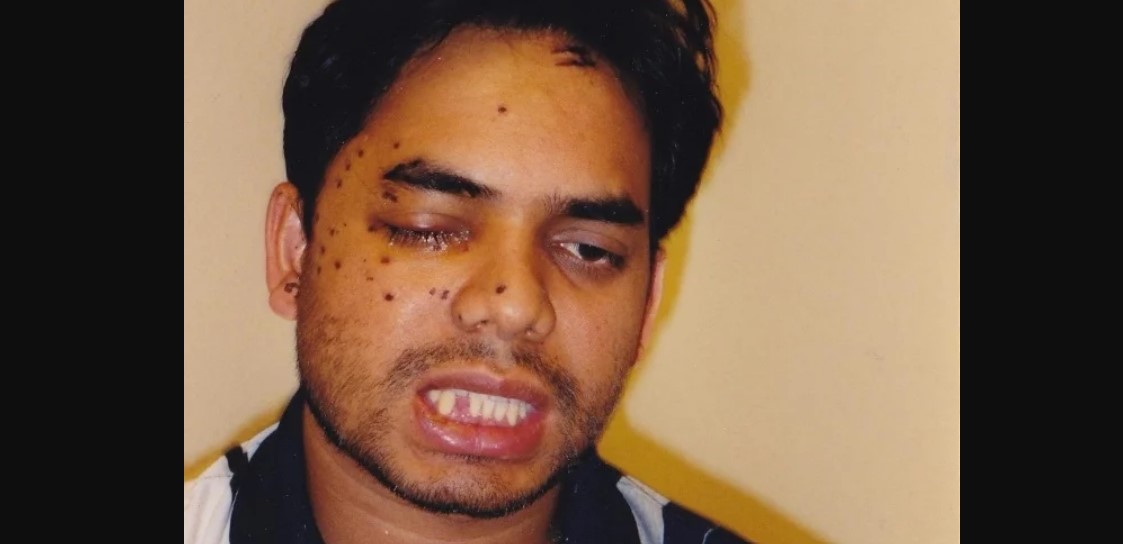 Rais Bhuiyan Now: Where is Mark Stroman's Attack Survivor Today? Update