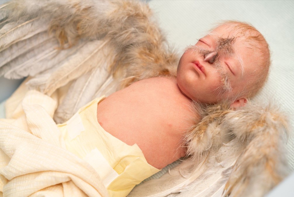 Is H5G9 Based on an Actual Virus? What is The Sick in Sweet Tooth?