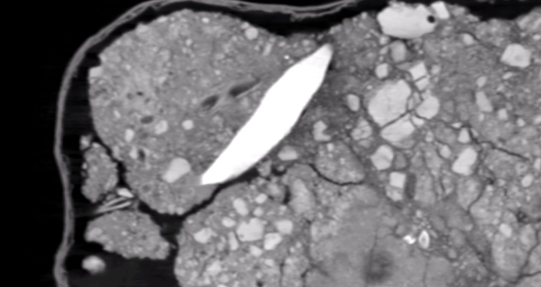 Did Homo Naledis Really Exist?