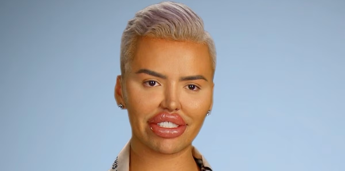 Is Botched Scripted? Is the TV Show Fake or Real?