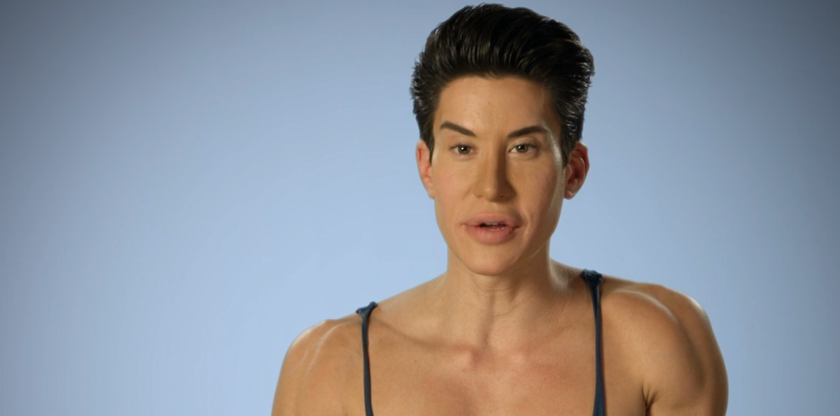 Botched Season 1: Where Are They Today? Update