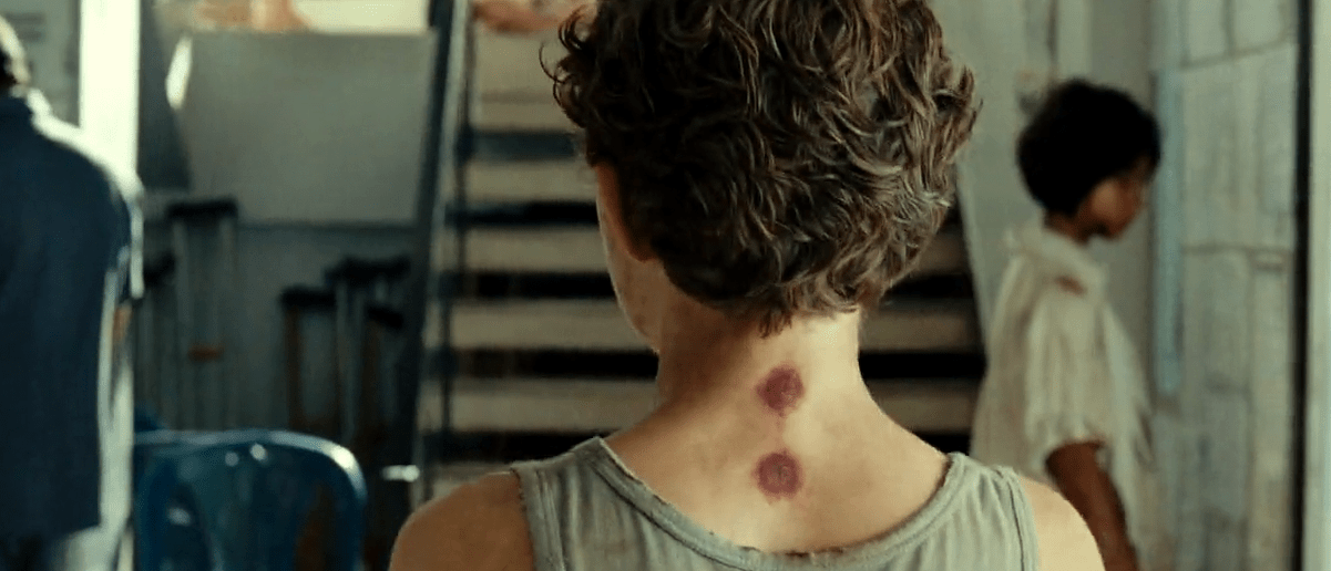 What Did the Mom Throw Up? What Are the Spots on Lucas' Back in The ...