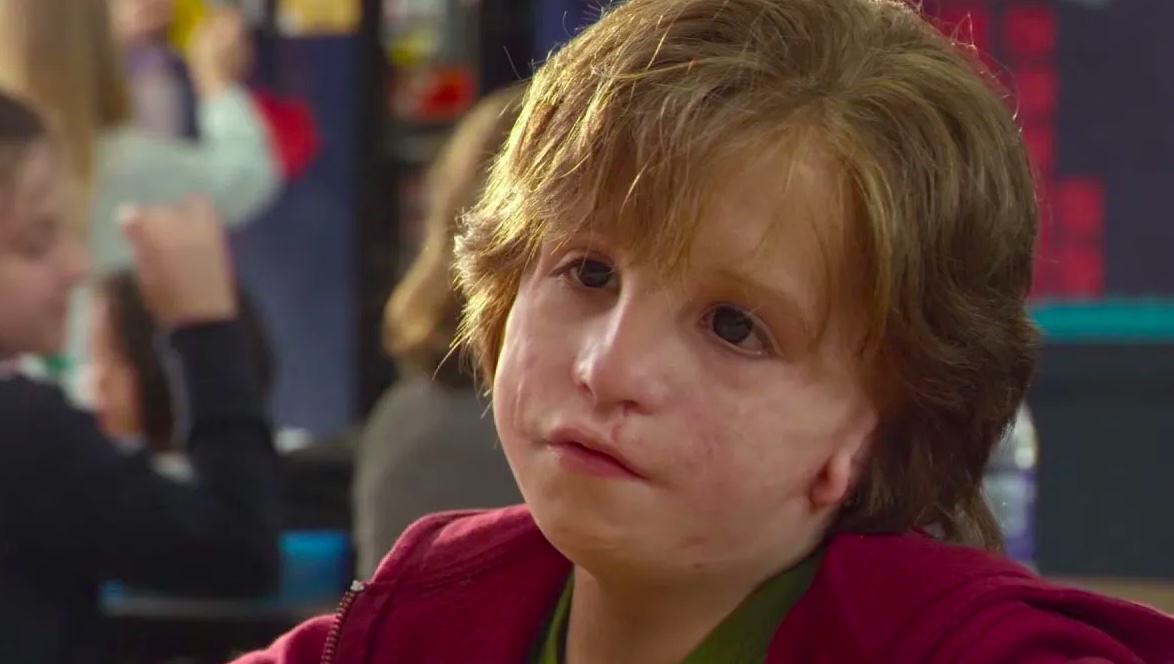 Wonder: Is August "Auggie" Pullman Based on a Real Kid?