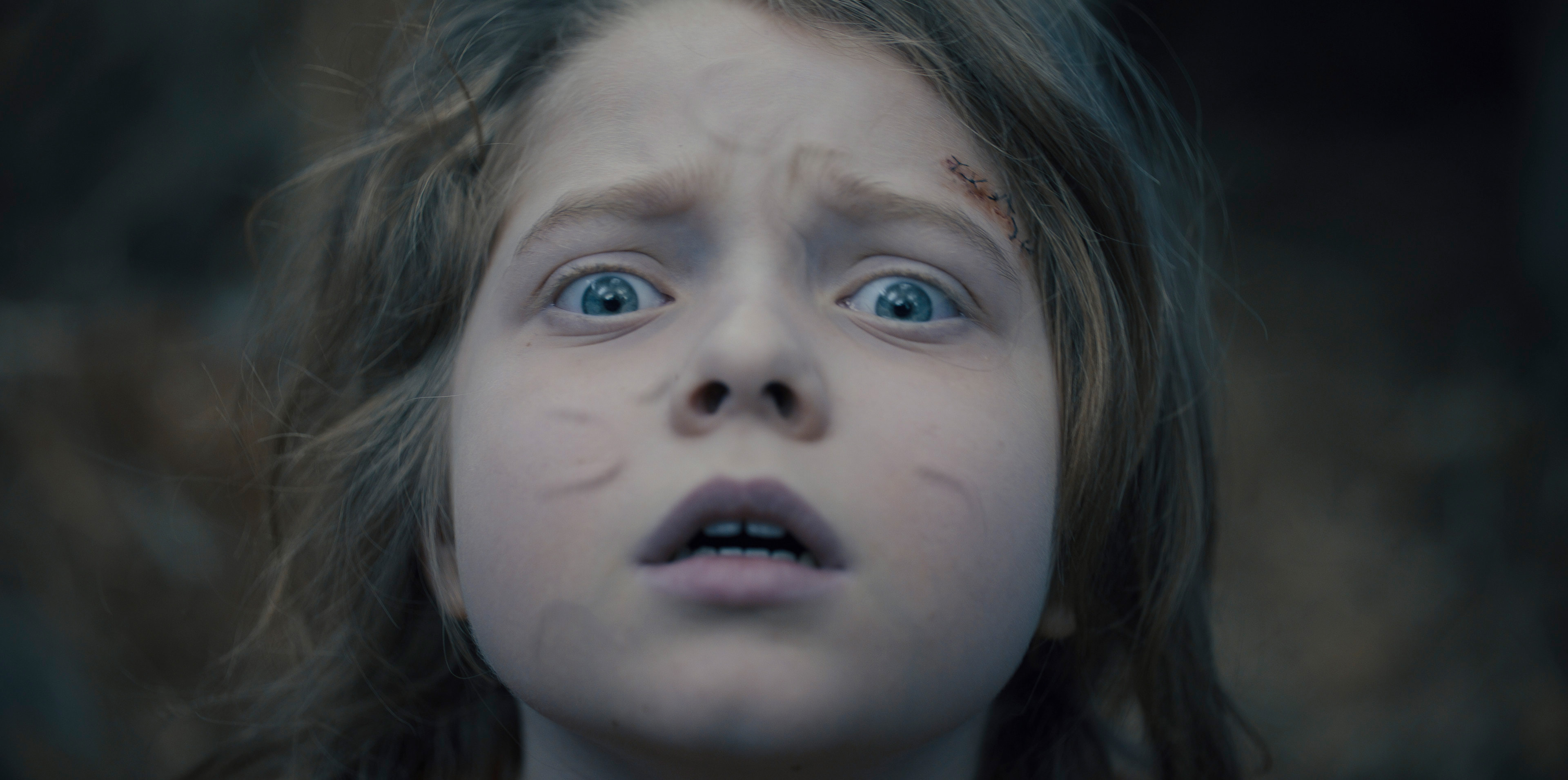 Before Episode 10 Recap and Ending, Explained: What Does the Worm in Eli's Head Mean?